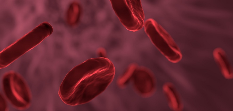 Trombolysegeassocieerde ernstige bloeding voorspellen bij patiënten met ...
