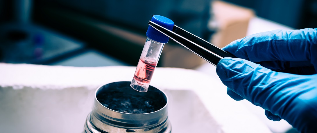 Evolutie van ILD na stamceltransplantatie of cyclofosfamide voor SSc ...