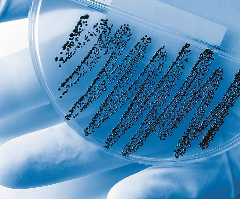 Dabigatran en het risico op 'Staphylococcus aureus'-bacteriëmie | MedNet