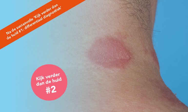Kijk verder dan de huid #2 - Patiënt Management | MedNet