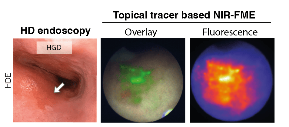 Fluorescentie-endoscopie voor snel en betrouwbaar diagnosticeren van ...