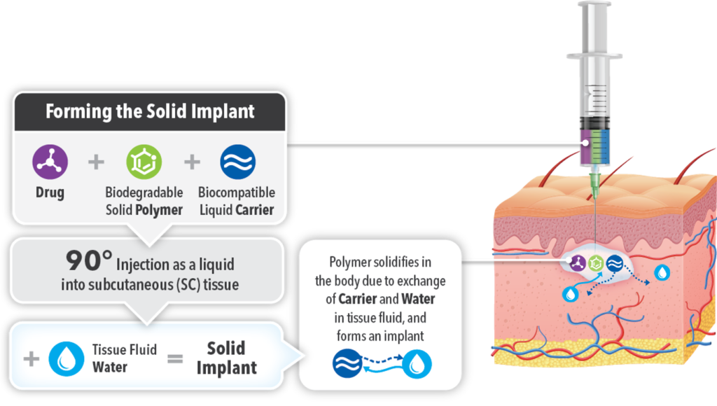 Extended release systeem | MedNet