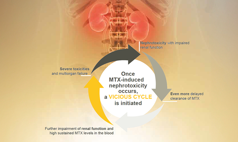 Vertraagde eliminatie van hoge dosering methotrexaat. Een nefrologisch ...