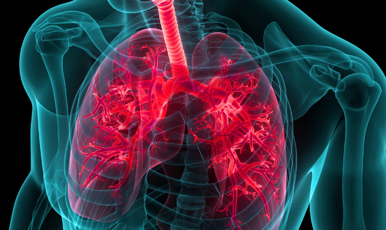 Targeting COPD with type 2 inflammation: emerging biologic landscape ...